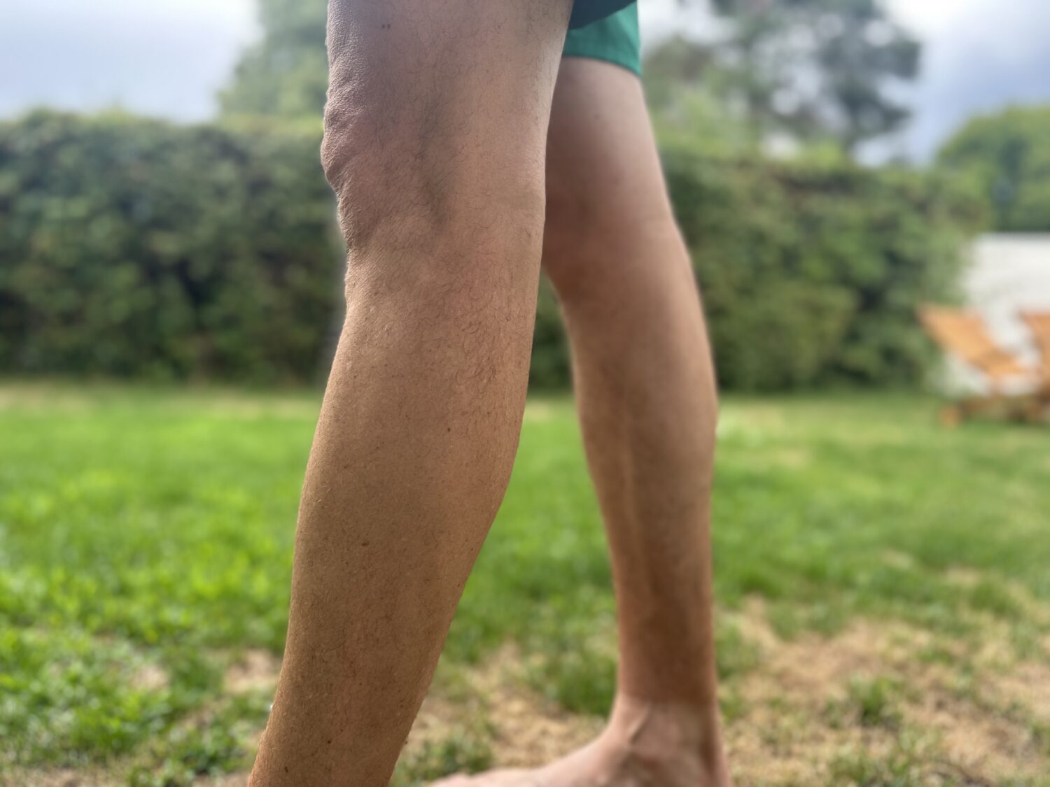 Muskelfaserriss erkennen – Diagnostik durch Radiologie | Mühleninsel